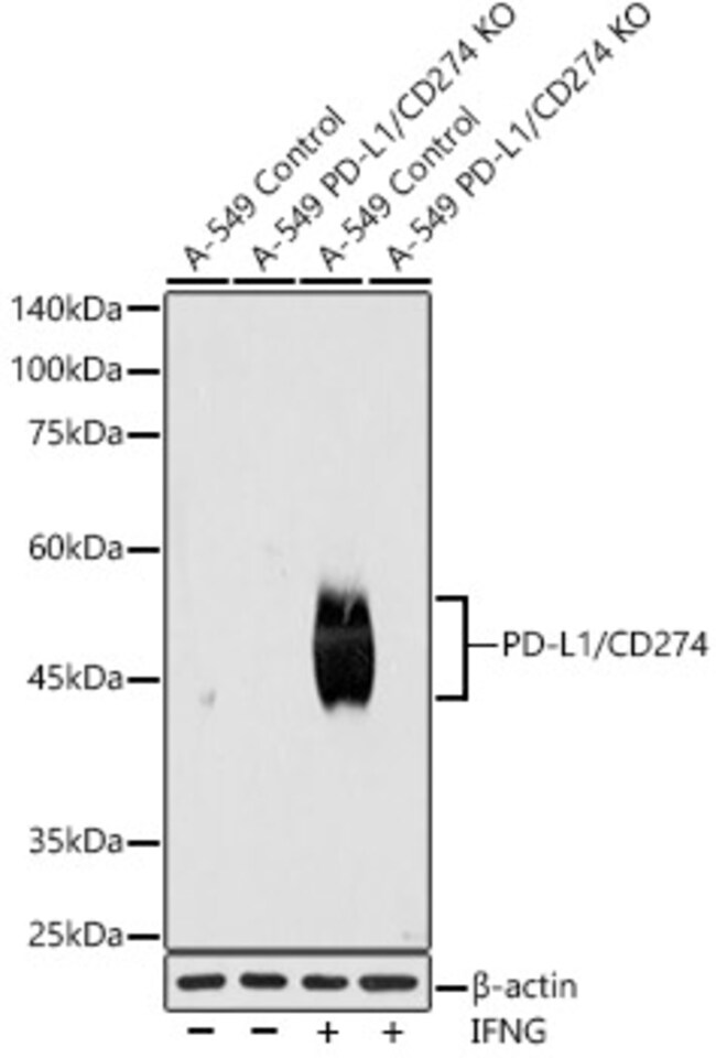 ABclonal Technology PD-L1/CD274 Rabbit mAb 100 L, Quantity: Each of 1 ...