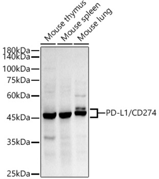 ABclonal Technology PD-L1/CD274 Rabbit mAb 100 L, Quantity: Each of 1 ...
