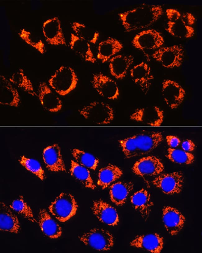 ABclonal Technology TOM20 Rabbit mAb 100 L, Quantity: Each of 1 ...