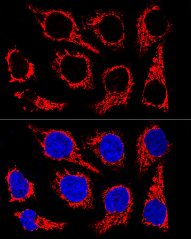 ABclonal Technology TOM20 Rabbit mAb 100 L, Quantity: Each of 1 ...