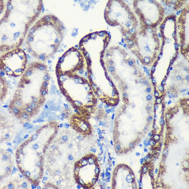 ABclonal Technology TOM20 Rabbit mAb 100 L, Quantity: Each of 1 ...