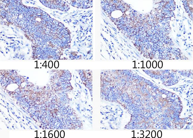 ABclonal Technology TOM20 Rabbit mAb 100 L, Quantity: Each of 1 ...