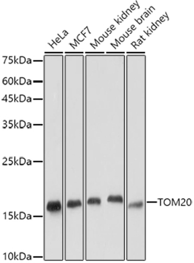 ABclonal Technology TOM20 Rabbit mAb 100 L, Quantity: Each of 1 ...