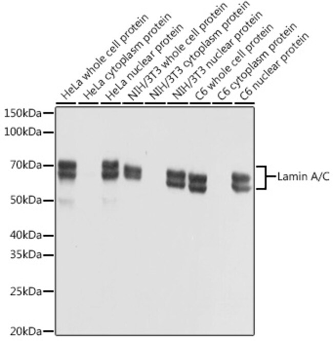 ABclonal Technology [KO Validated] Lamin A/C Rabbit mAb 100 L, Quantity: | Fisher Scientific