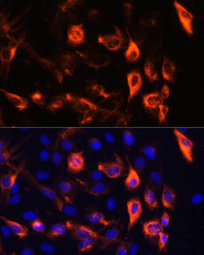 ABclonal Technology Vimentin Rabbit mAb 100 L, Quantity: Each of 1 ...