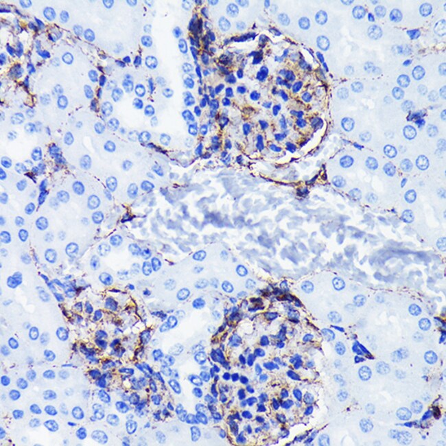 ABclonal Technology Vimentin Rabbit mAb 100 L, Quantity: Each of 1 ...