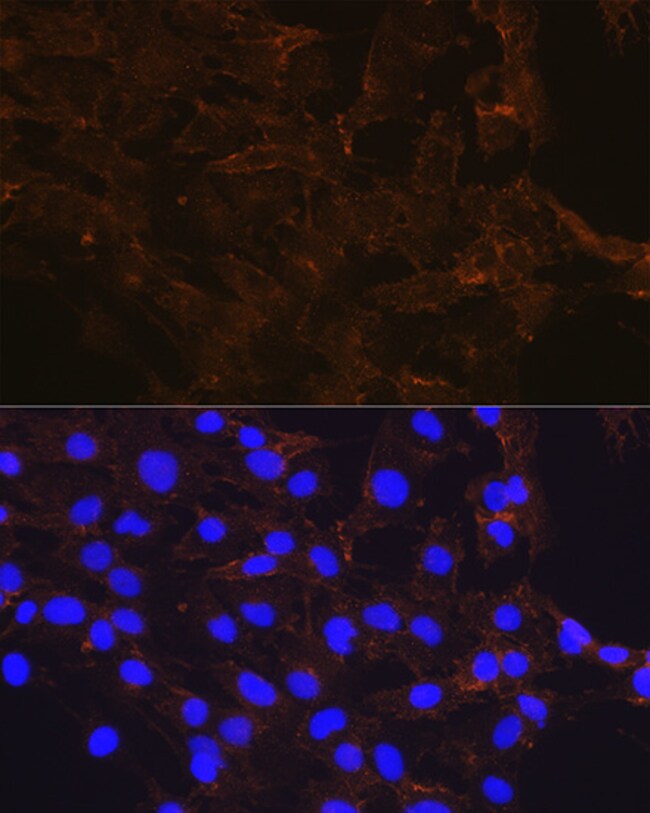 ABclonal Technology [KO Validated] -Catenin Rabbit mAb 100 L, Quantity ...