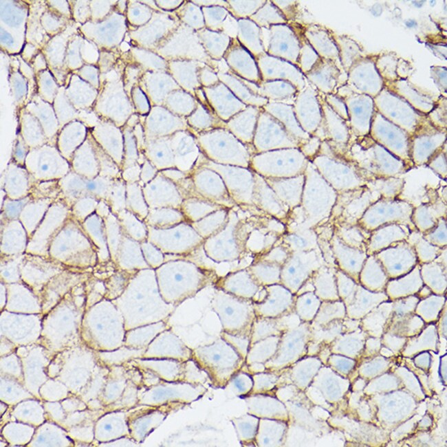 ABclonal Technology [KO Validated] -Catenin Rabbit mAb 100 L, Quantity ...