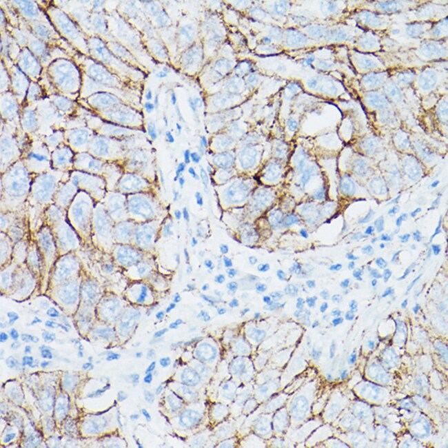 ABclonal Technology [KO Validated] -Catenin Rabbit mAb 100 L, Quantity ...