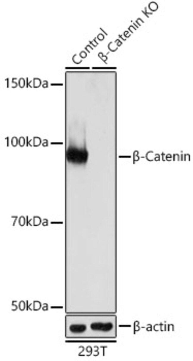 ABclonal Technology [KO Validated] -Catenin Rabbit mAb 100 L, Quantity: | Fisher Scientific