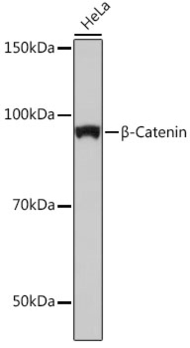ABclonal Technology [KO Validated] -Catenin Rabbit mAb 100 L, Quantity ...
