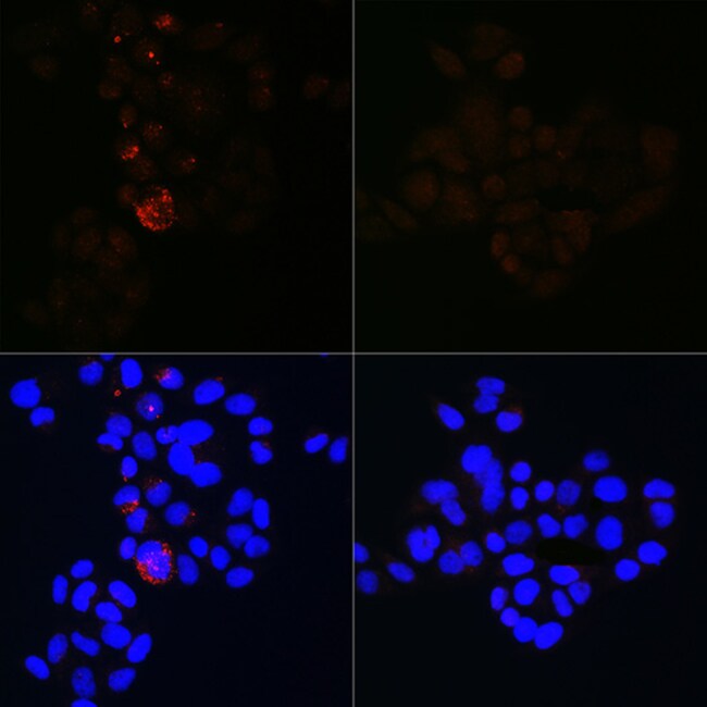 ABclonal Technology [KO Validated] LC3B Rabbit mAb 100 L, Quantity ...
