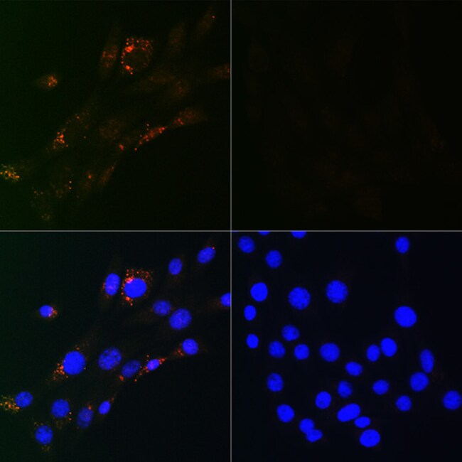 ABclonal Technology [KO Validated] LC3B Rabbit mAb 100 L, Quantity ...