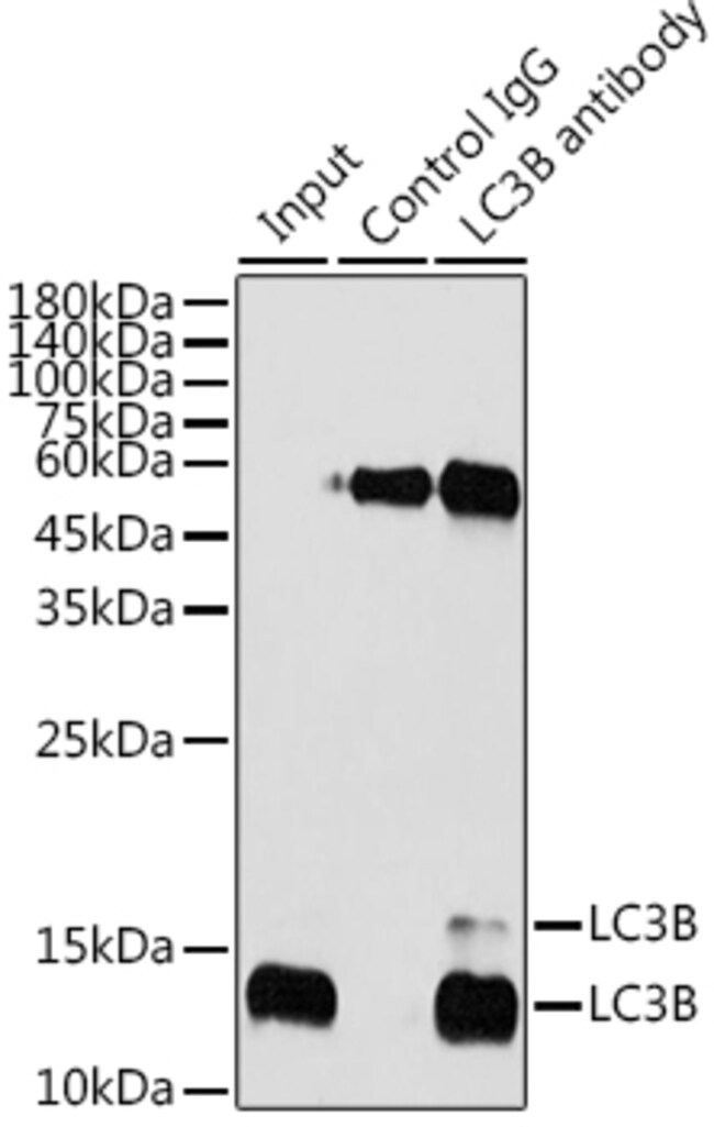 ABclonal Technology [KO Validated] LC3B Rabbit mAb 100 L, Quantity ...