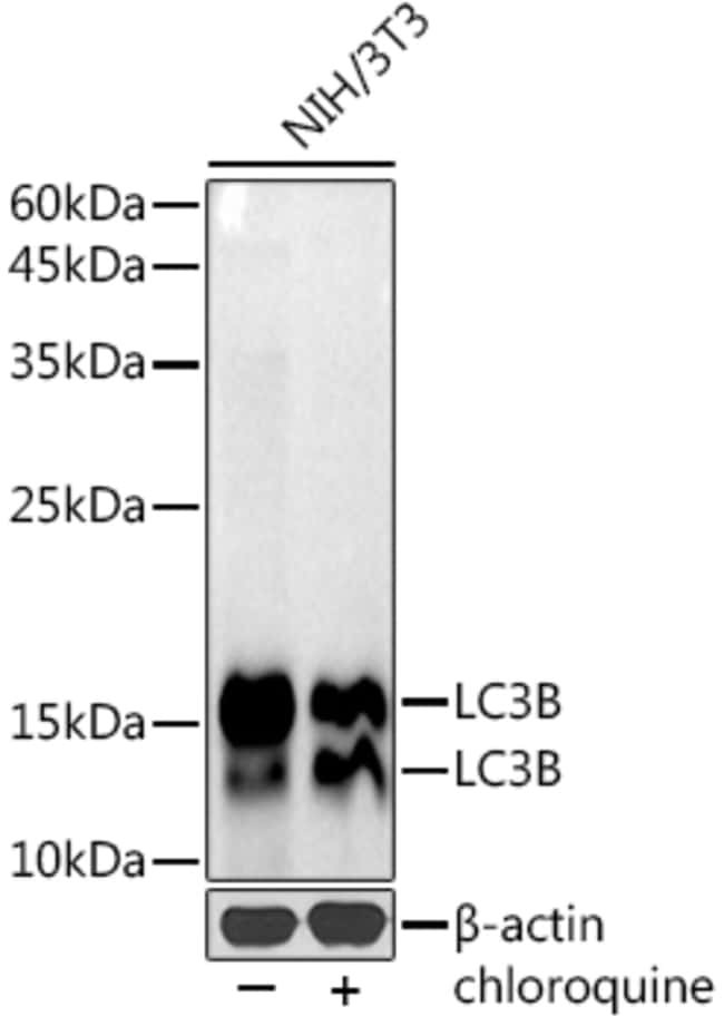ABclonal Technology [KO Validated] LC3B Rabbit mAb 100 L, Quantity ...