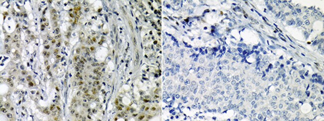 ABclonal Technology PMS2 Rabbit mAb 100 L, Quantity: Each of 1 | Fisher ...