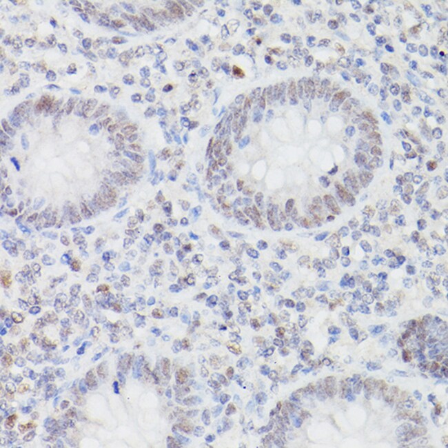 ABclonal Technology PMS2 Rabbit mAb 100 L, Quantity: Each of 1 | Fisher ...