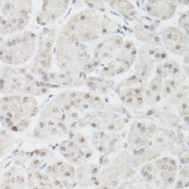 ABclonal Technology PMS2 Rabbit mAb 100 L, Quantity: Each of 1 | Fisher ...