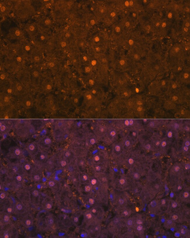 ABclonal Technology Arginase 1 (ARG1) Rabbit mAb 100 L, Quantity: Each ...