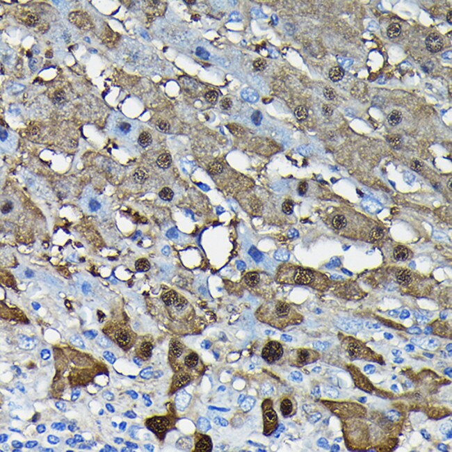 ABclonal Technology Arginase 1 (ARG1) Rabbit mAb 100 L, Quantity: Each ...