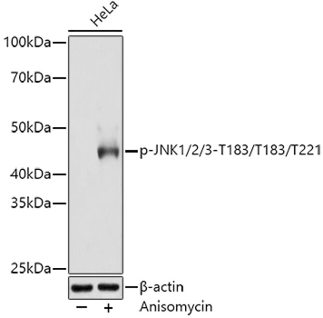 ABclonal Technology Phospho-JNK1/2/3-T183/T183/T221 Rabbit mAb 100 L ...