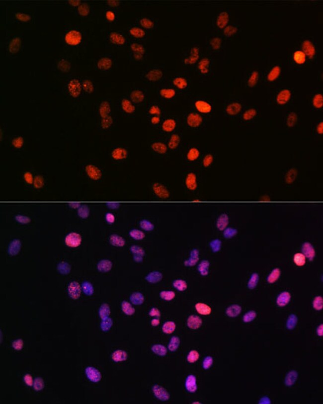 ABclonal Technology Phospho-Histone H2AX-S139 Rabbit mAb 100 L ...