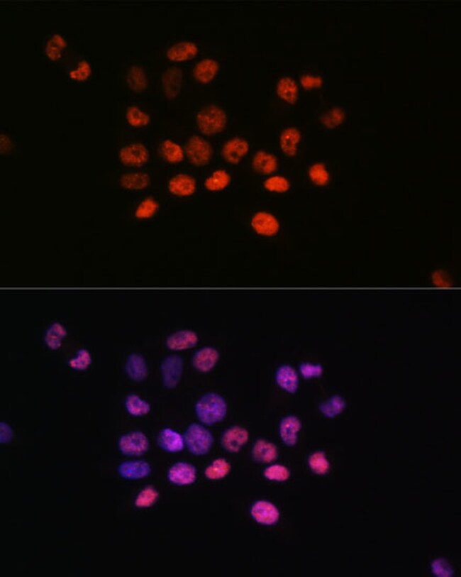 ABclonal Technology Phospho-Histone H2AX-S139 Rabbit mAb 100 L ...