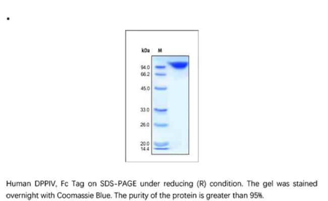 ACROBiosystems Recombinant Protein;Human DPPIV / CD26 Protein, Fc Tag;HEK293;50UG;DP4,DPP4,DPP-4 ...