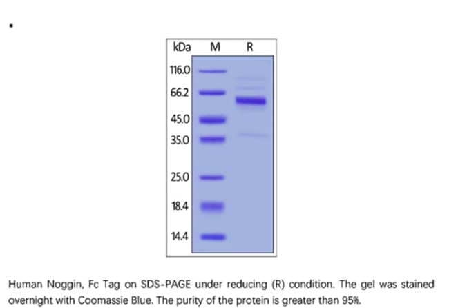 ACROBiosystems Recombinant Protein;Human Noggin Protein, Fc Tag;HEK293;1MG;NON,Noggin,NOG,SYM1 ...