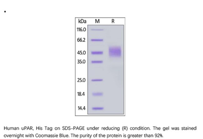 ACROBiosystems Recombinant Protein;Human uPAR / PLAUR Protein;HEK293 ...