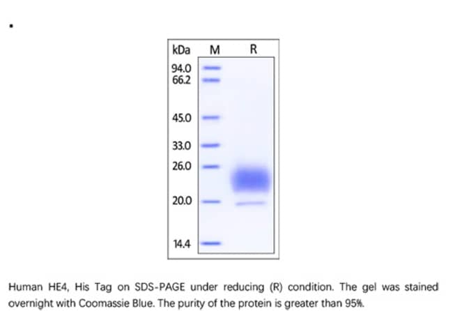 ACROBiosystems ACROBiosystems Human HE4 / WFDC2 Protein, His Tag | Fisher Scientific