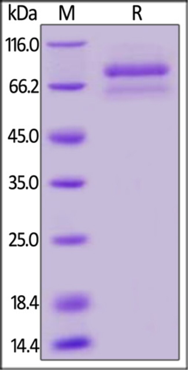 ACROBiosystems ACROBiosystems Biotinylated Human ANGPTL7 / CDT6 Protein, | Fisher Scientific