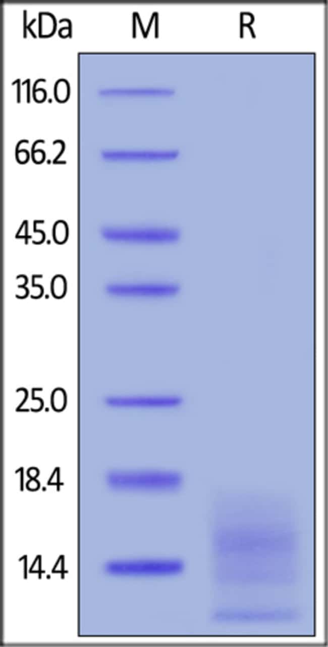 ACROBiosystems ACROBiosystems FITC-Labeled Human BCMA / TNFRSF17 ... ACROBiosystems ACROBiosystems FITC-Labeled Human BCMA / TNFRSF17 ...