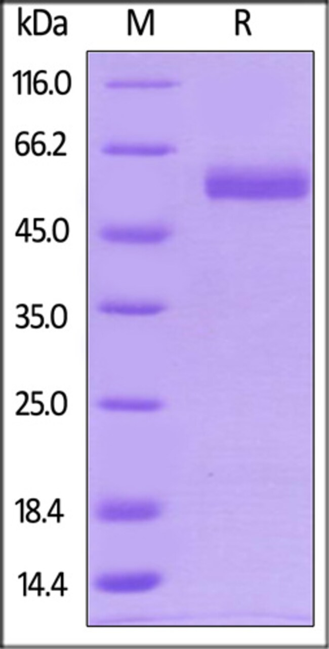 ACROBiosystems ACROBiosystems Biotinylated Human CD4 Protein, His,Avitag | Fisher Scientific