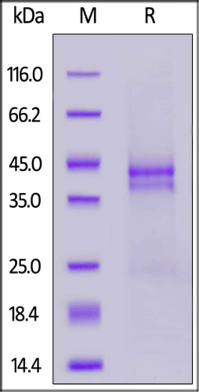 ACROBiosystems ACROBiosystems Human CTGF / CCN2 Protein, His Tag, Quantity: | Fisher Scientific