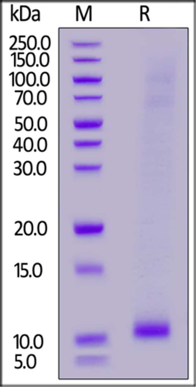 ACROBiosystems ACROBiosystems Human EGF Protein, His Tag | Fisher Scientific