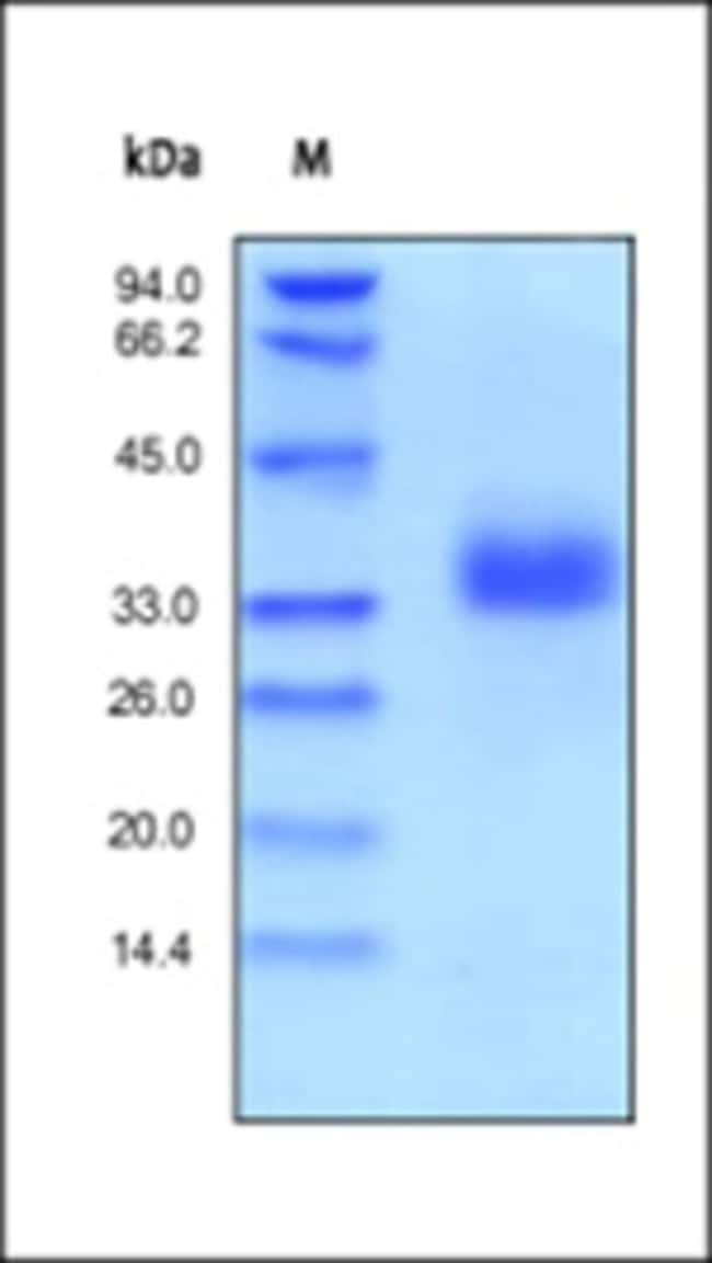 ACROBiosystems ACROBiosystems Human EpCAM / TROP1 Protein, His Tag, Quantity: | Fisher Scientific