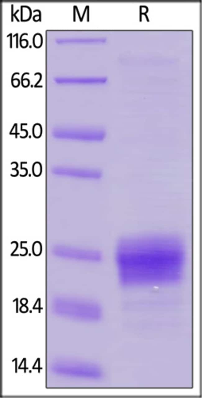ACROBiosystems ACROBiosystems Human Flt-3 Ligand Protein, His Tag, Quantity: | Fisher Scientific