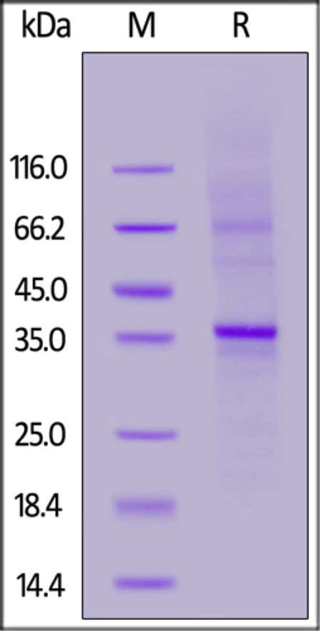 ACROBiosystems ACROBiosystems Human GPRC5D Protein, Flag,His Tag | Fisher Scientific