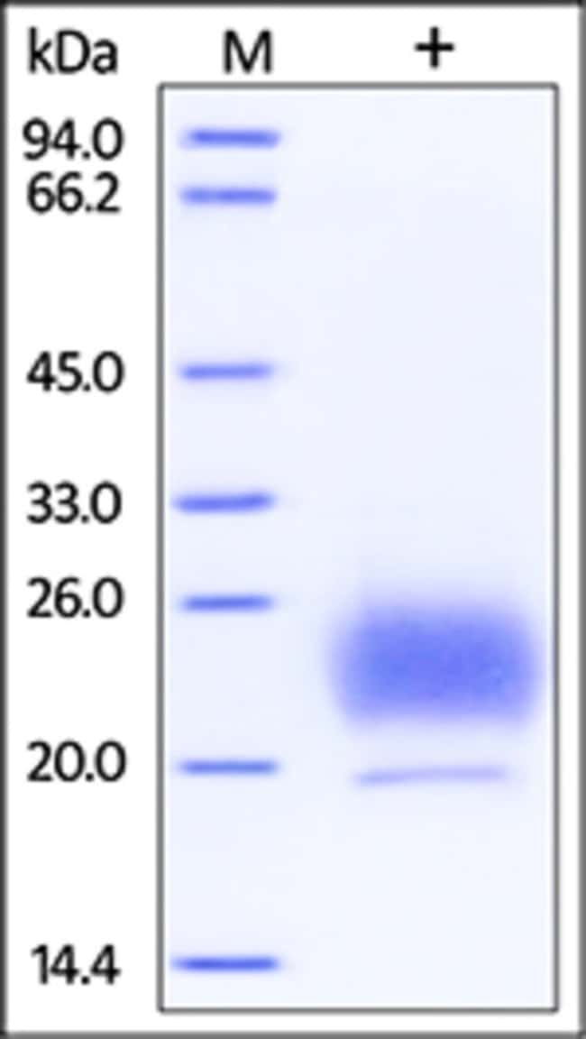 ACROBiosystems ACROBiosystems Human HE4 / WFDC2 Protein, His Tag, Quantity: | Fisher Scientific