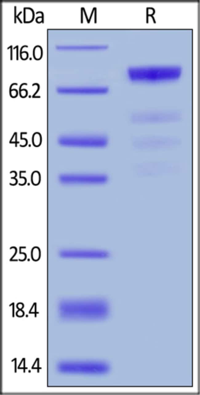 ACROBiosystems ACROBiosystems Human IL-3 R alpha / CD123 Protein, Llama | Fisher Scientific