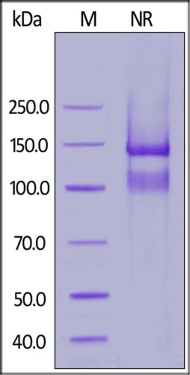 ACROBiosystems ACROBiosystems Human Integrin alpha 6 beta 1 (ITGA6 ...