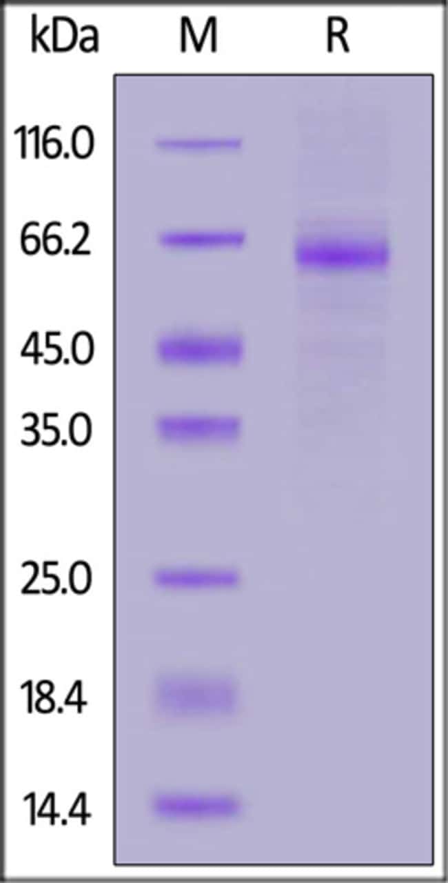 ACROBiosystems ACROBiosystems Human MARCO Protein, His Tag, Quantity ...