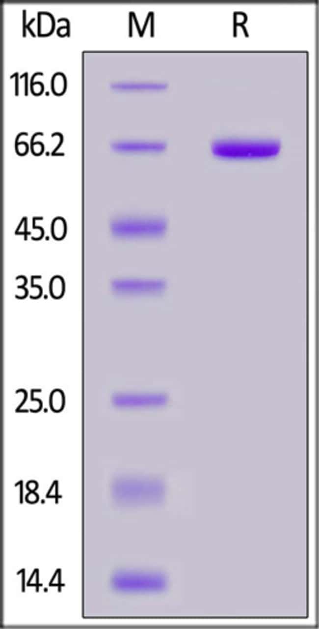 ACROBiosystems ACROBiosystems Rat Nectin-4 Protein, Fc Tag (MALS ...