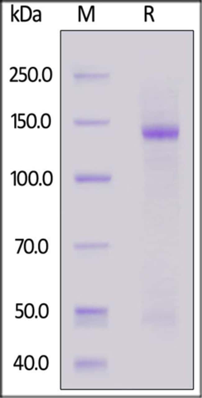 ACROBiosystems ACROBiosystems Human Nucleolin / NCL Protein, Fc Tag, Quantity: | Fisher Scientific