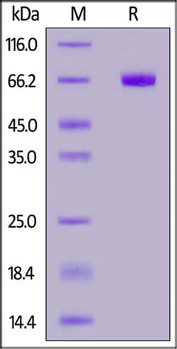 ACROBiosystems ACROBiosystems Biotinylated Human PD-L1 / B7-H1 Protein, | Fisher Scientific