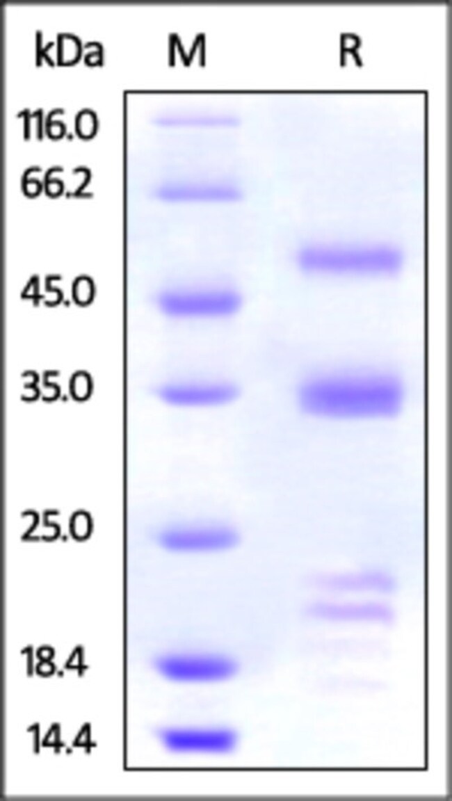 ACROBiosystems ACROBiosystems Human PLAU / uPA Protein, His Tag ...