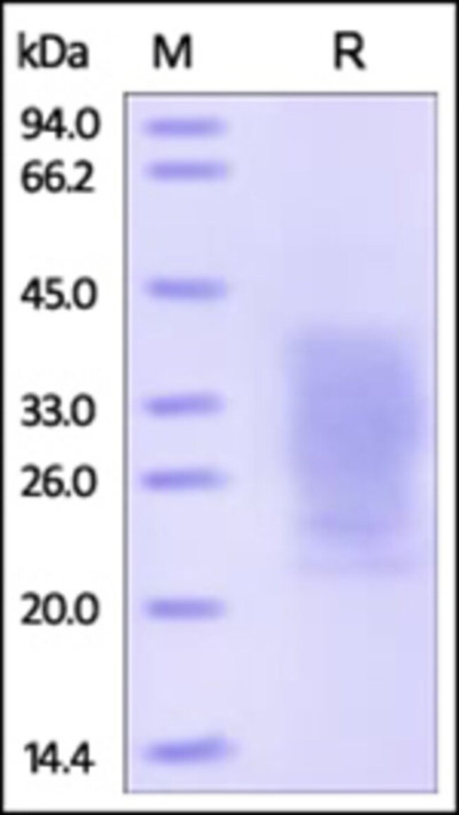 ACROBiosystems ACROBiosystems Human PTH1R / PTHR1 Protein, His Tag, Quantity: | Fisher Scientific