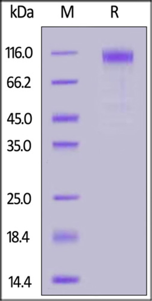 ACROBiosystems SARS-CoV-2 (COVID-19) S1 protein (P681H), His Tag ...