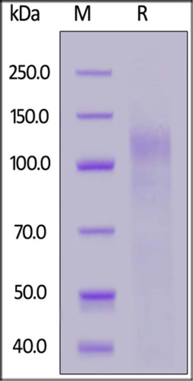 ACROBiosystems ACROBiosystems SARS-CoV-2 S1 protein (L18F, D80A, D215G, | Fisher Scientific